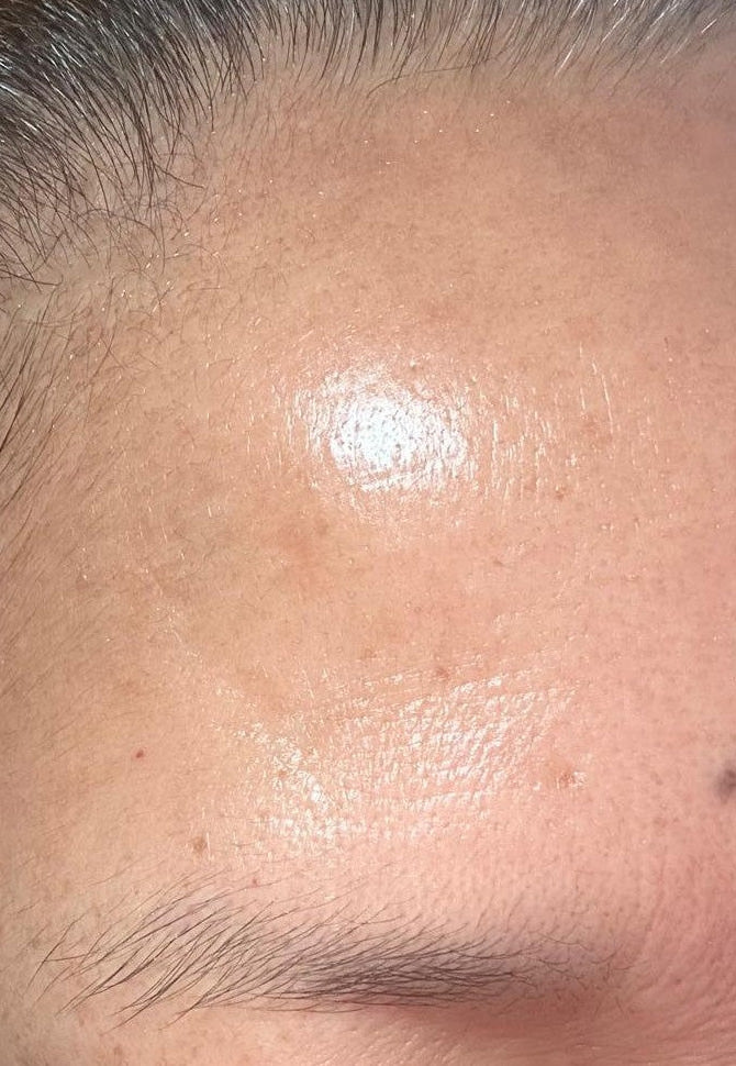 LOOK25® | Hydrogen & Oxygen Nano Vapor Skin Recovery Device – Look 25