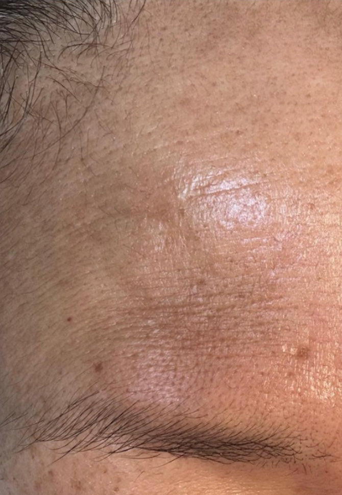 LOOK25® | Hydrogen & Oxygen Nano Vapor Skin Recovery Device – Look 25